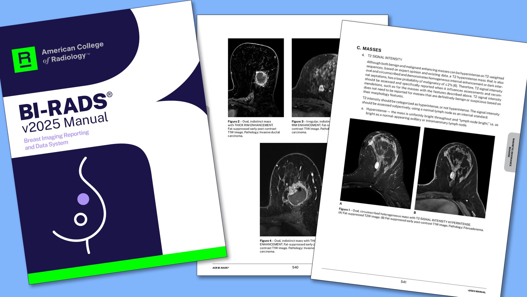 BI-RADS® v2025 Is Your Definitive Guide to Breast Imaging