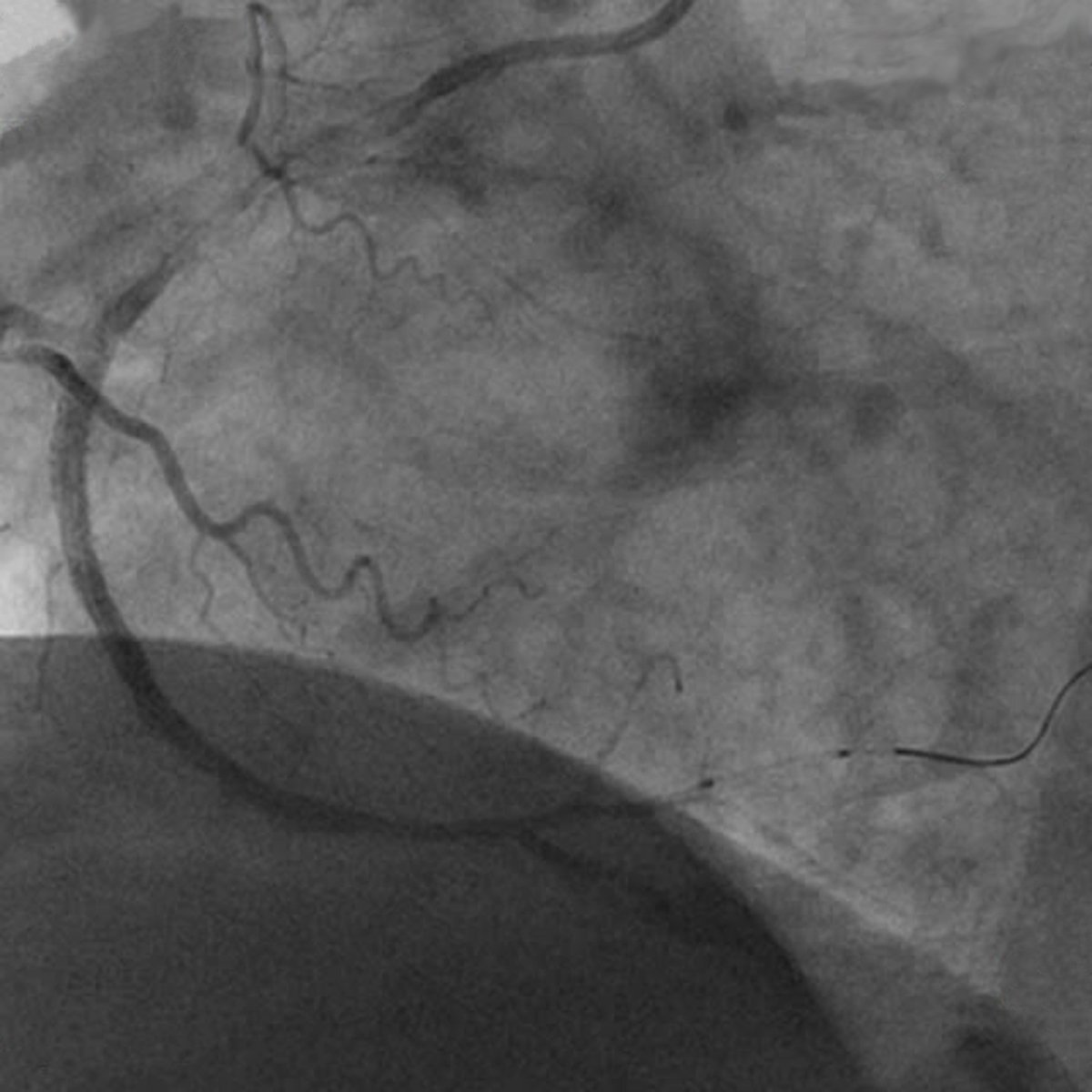 ACR Education Center Cardiac MR Course