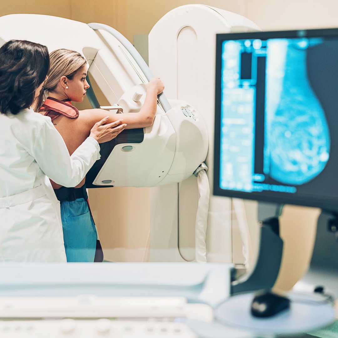 Collaborative Advocacy and the Science of Breast Cancer Screening