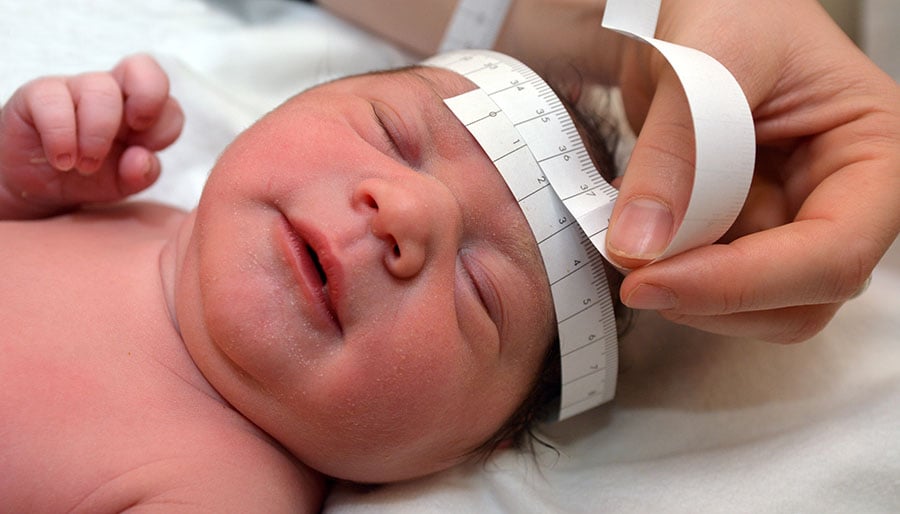 Babies’ head shape: What to know and when to worry | Children's Wisconsin