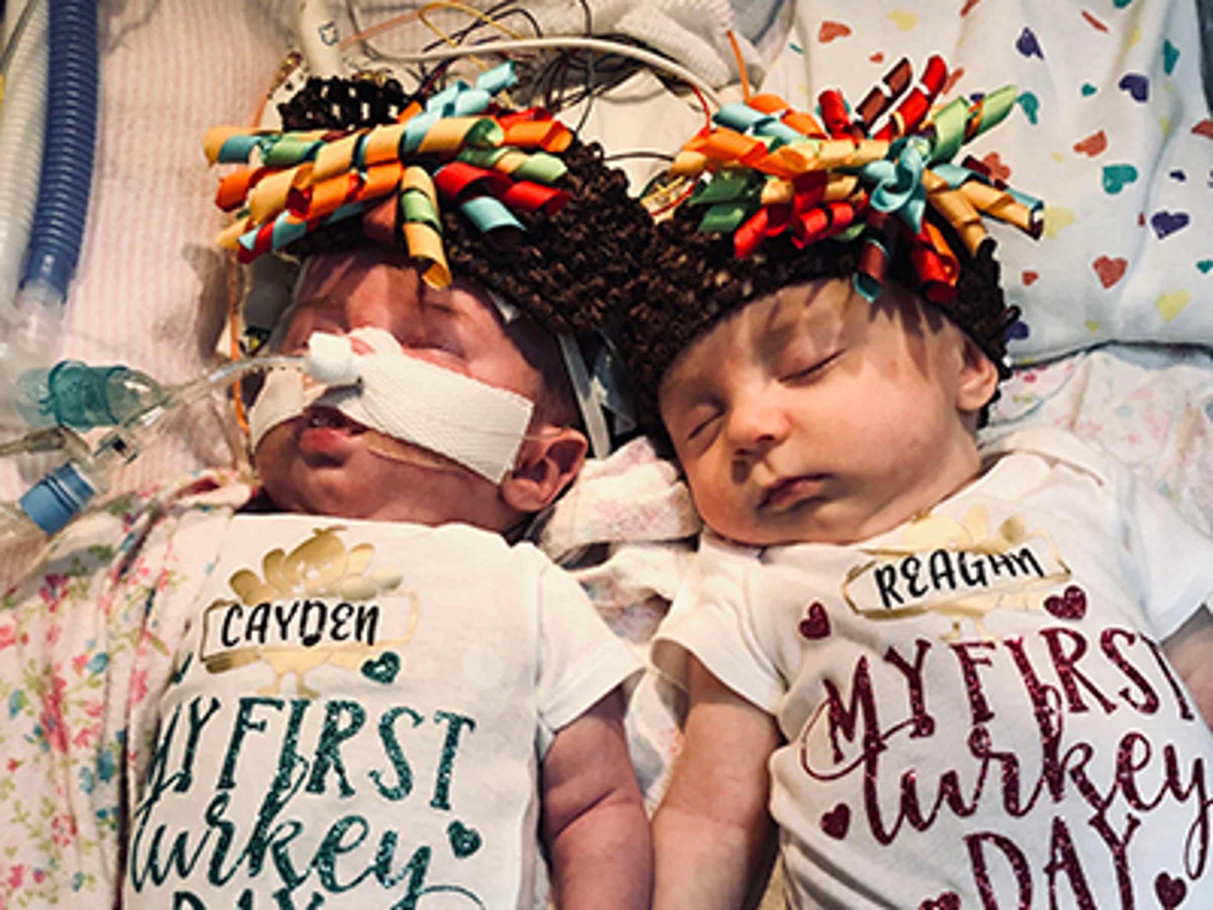 Pediatric Cardiac Catheterization - Conditions and Treatments ...