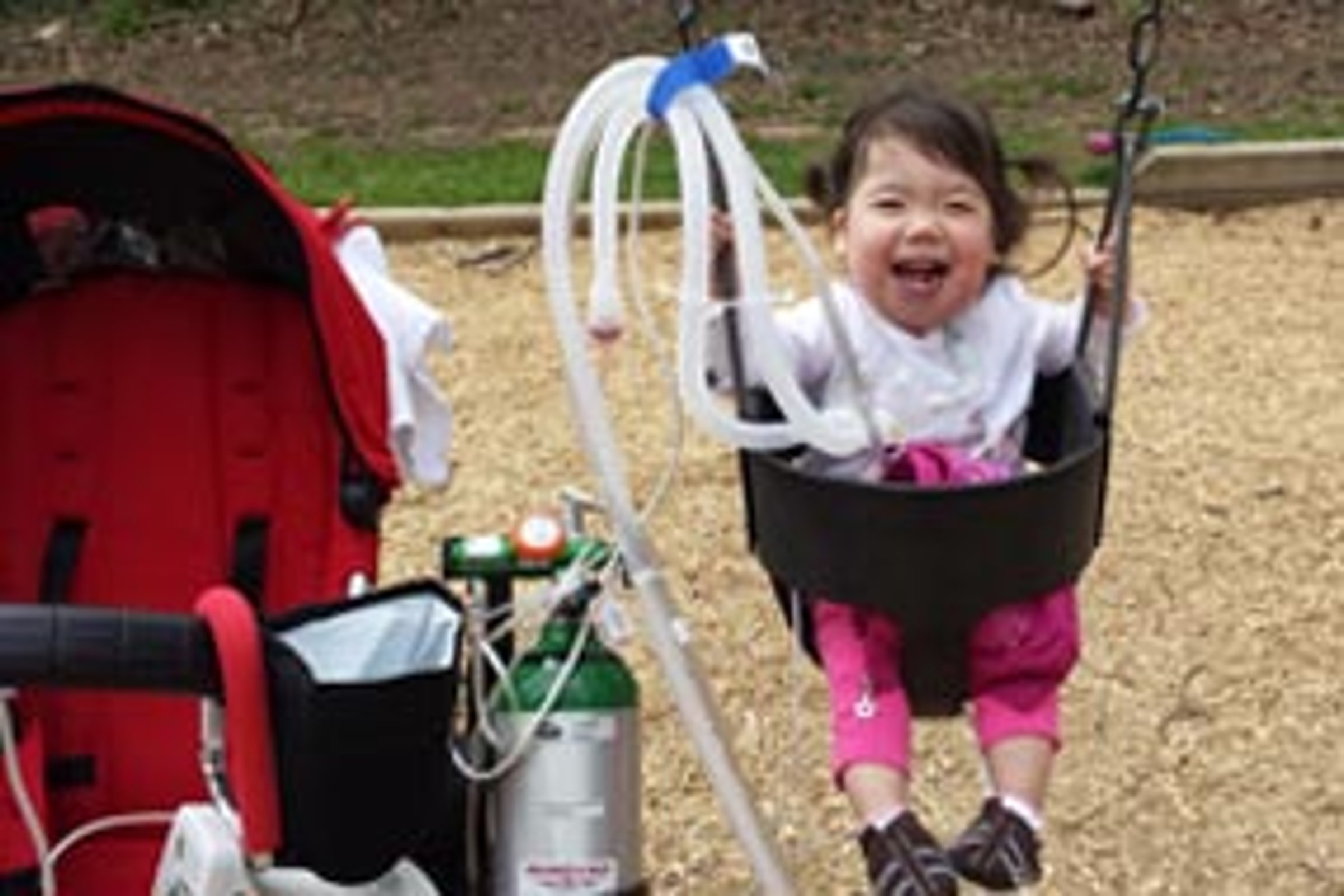 Patent Ductus Arteriosus (PDA) - Conditions and Treatments | Children's ...