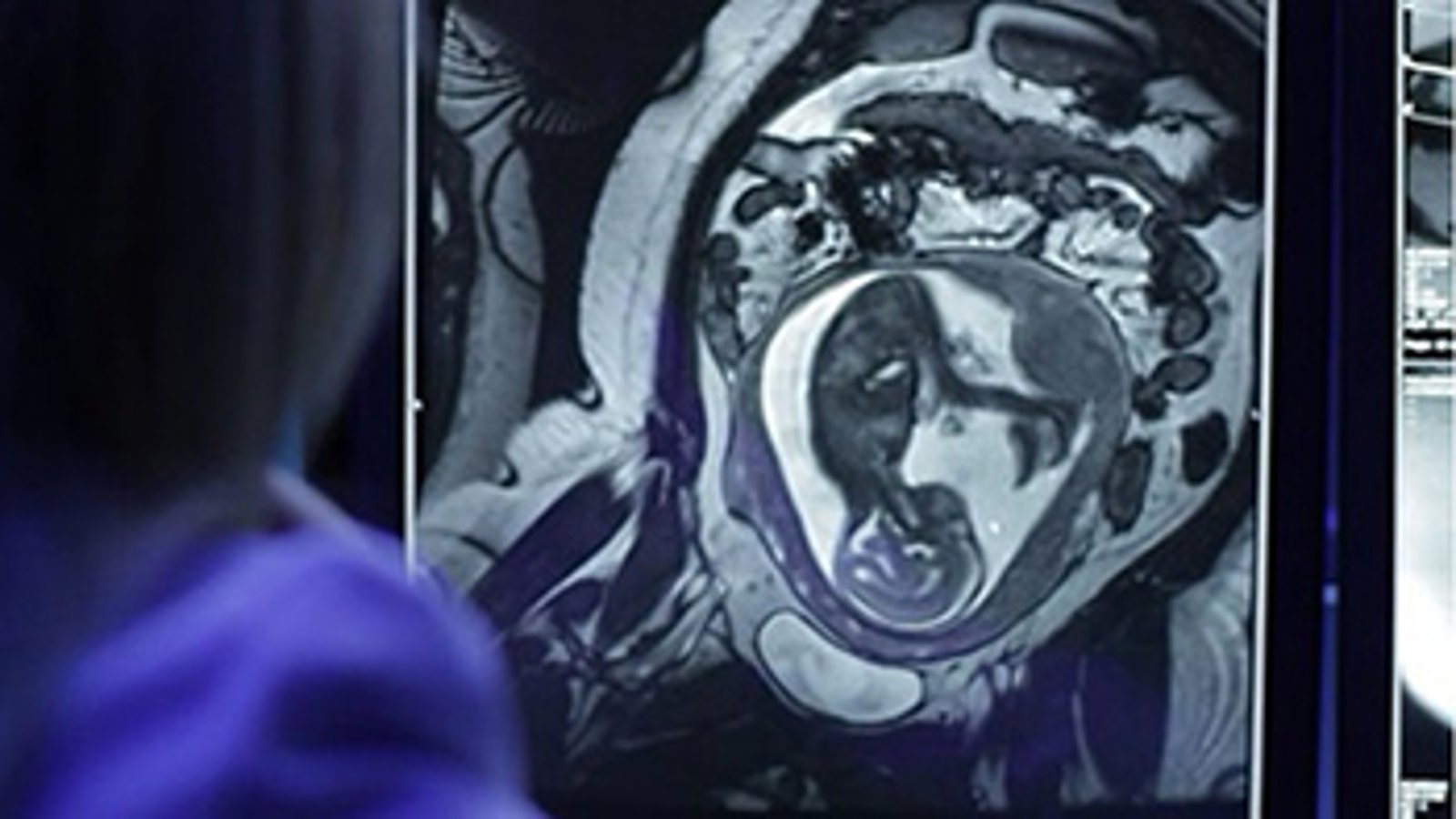 Developing Brain Institute - For Families | Children's National Hospital