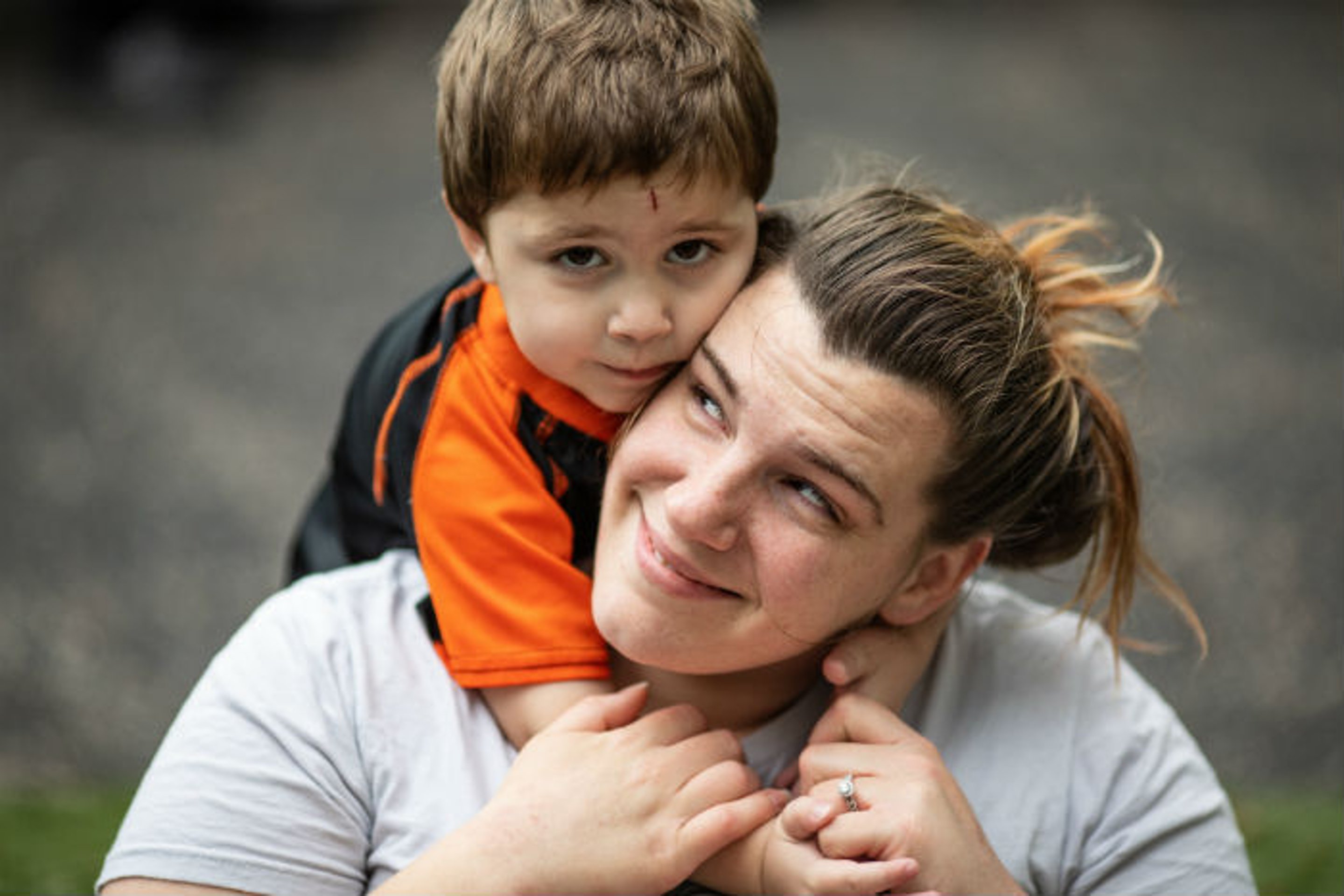 Tuberous Sclerosis Program | Children's National | Children's National ...