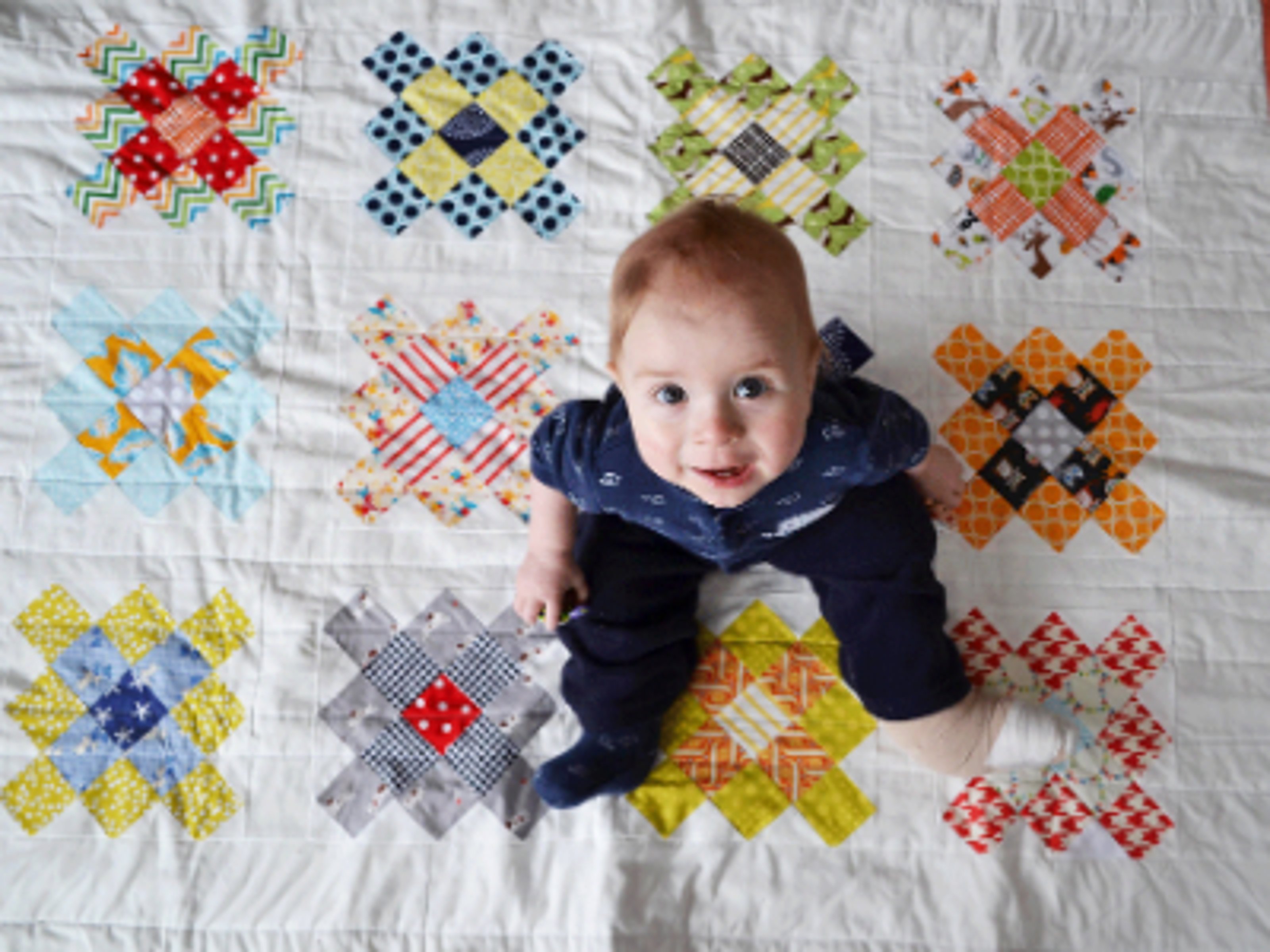 Kaposiform Hemangioendothelioma with Kasabach-Merritt Syndrome ...