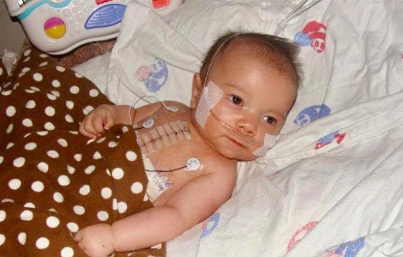 Pediatric Tetralogy of Fallot (TOF) - Conditions and Treatments ...