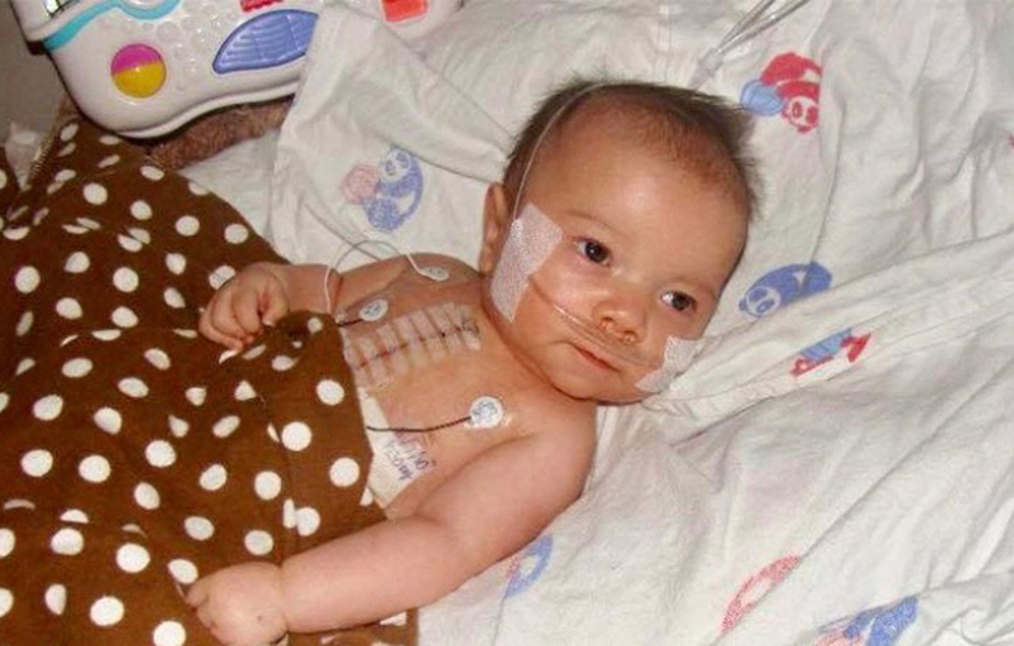 Pediatric Tetralogy of Fallot (TOF) - Conditions and Treatments ...