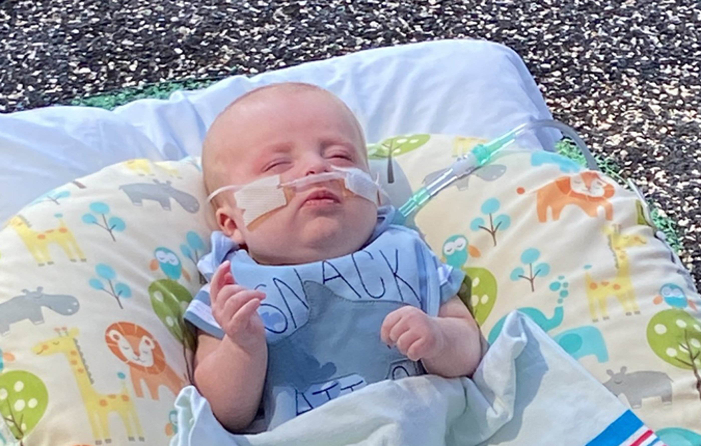 Pediatric Extracorporeal Membrane Oxygenation (ECMO) - Conditions and ...