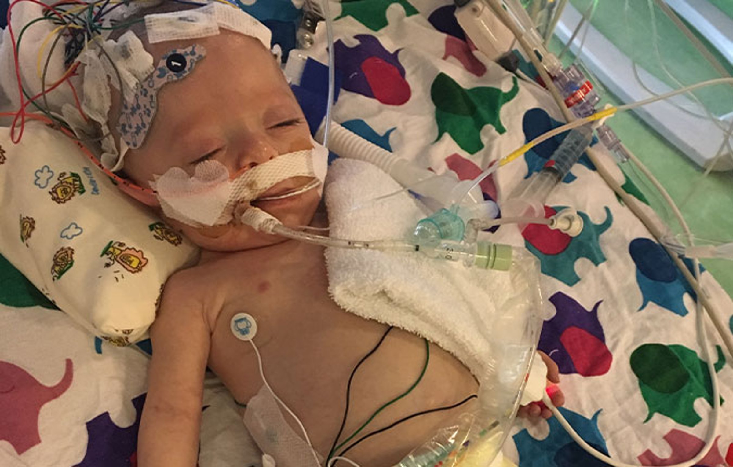 Cardiac Intensive Care Unit (CICU) | Children's National Hospital