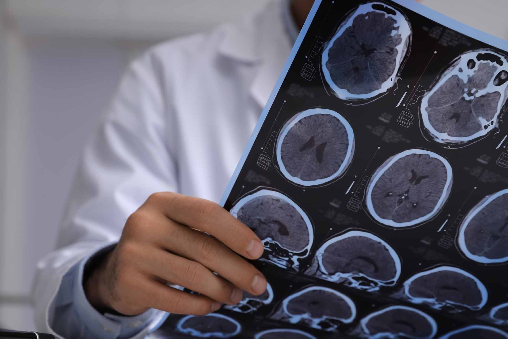What is TBI and how is it treated?