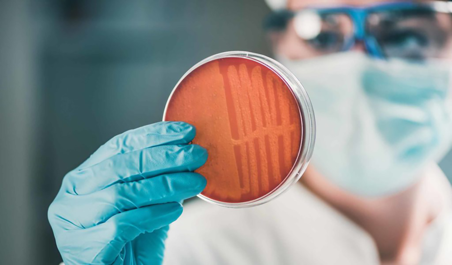 Leading the way in environmental antimicrobial resistance research ...