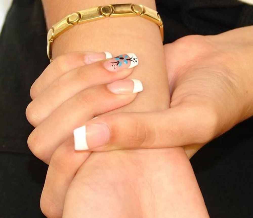 Sindrome di Marfan - Problemi di salute dei bambini - Manuale MSD ...