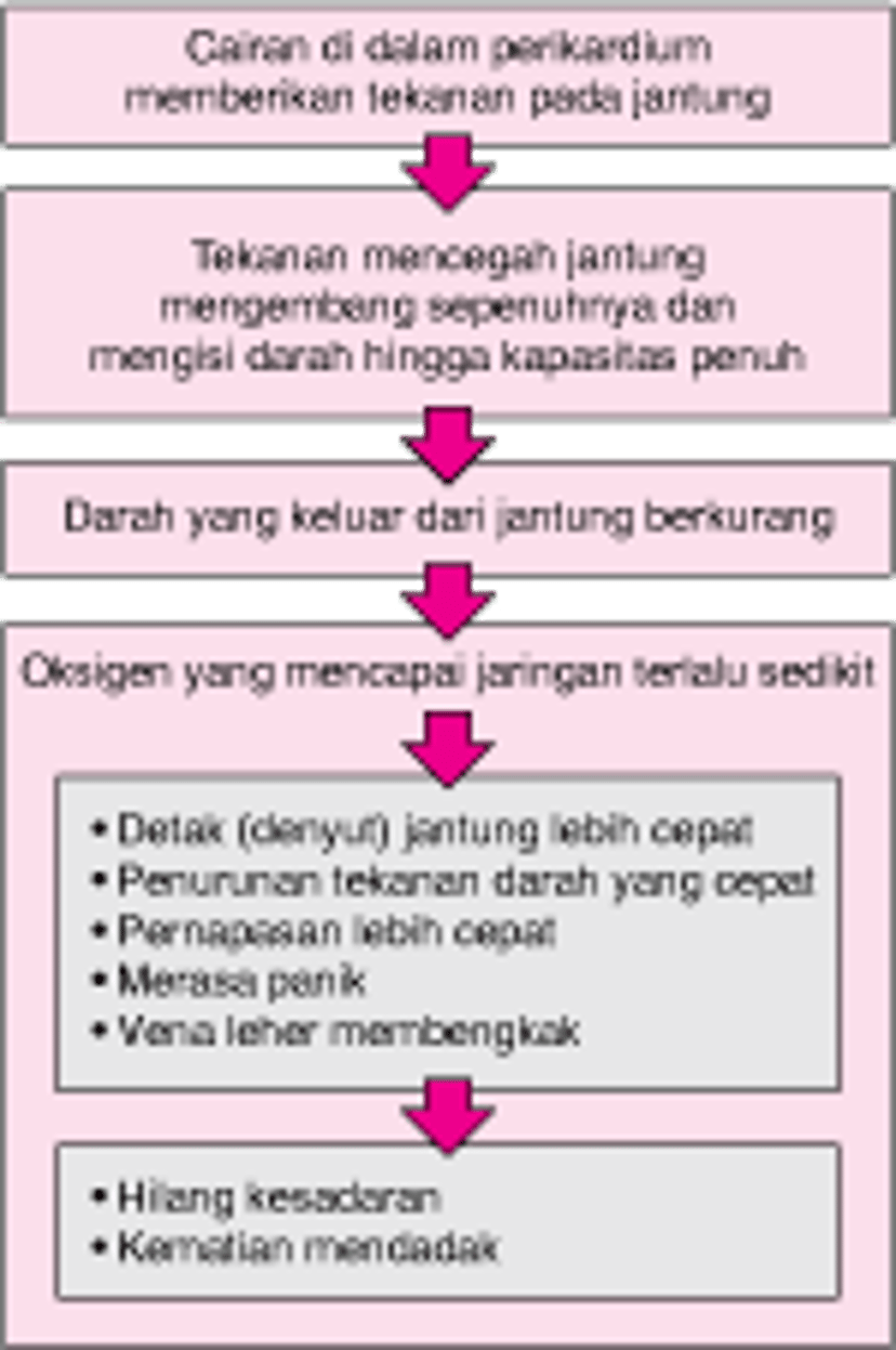 Tamponade Jantung - Cedera dan Keracunan - Manual MSD Versi Konsumen