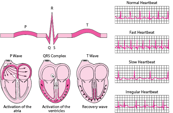 Électrocardiographie - Troubles cardiaques et vasculaires - Manuels ...