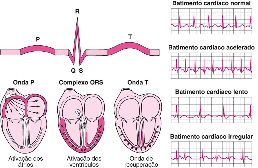 Fibrilação atrial e flutter atrial - Distúrbios do coração e dos vasos ...