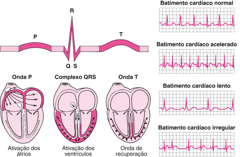 Fibrilação atrial e flutter atrial - Distúrbios do coração e dos vasos ...