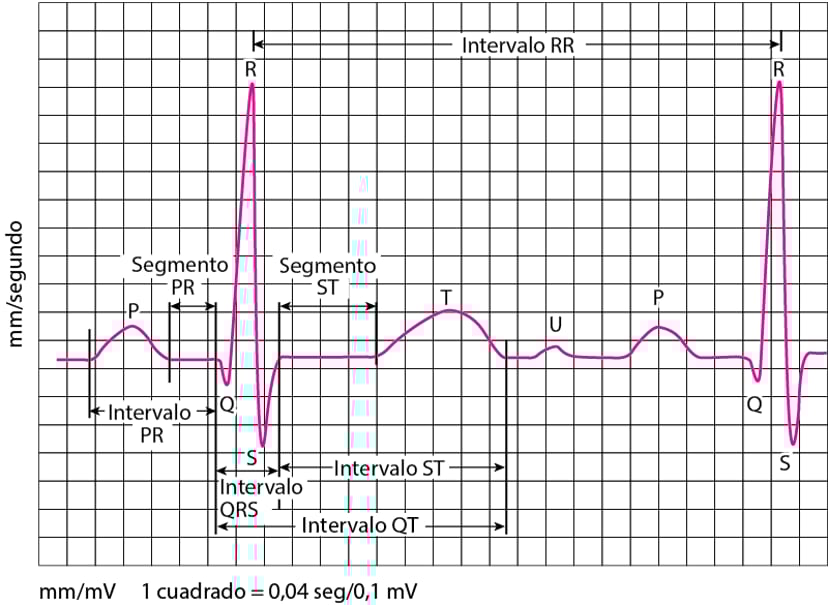 Image:ECG: lectura de las ondas-Manual MSD versión para público general