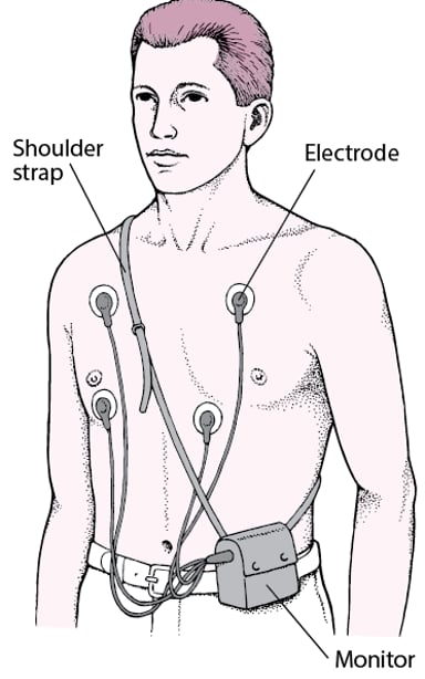 Continuous Ambulatory Electrocardiography - Continuous Ambulatory ...