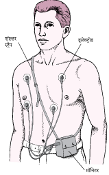 कंटीन्युअस एम्बुलेटरी इलेक्ट्रोकार्डियोग्राफी - हृदय और रक्त वाहिकाओं ...