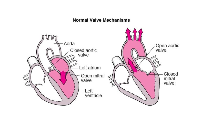 Overview of Heart Valve Disorders - Heart and Blood Vessel Disorders ...