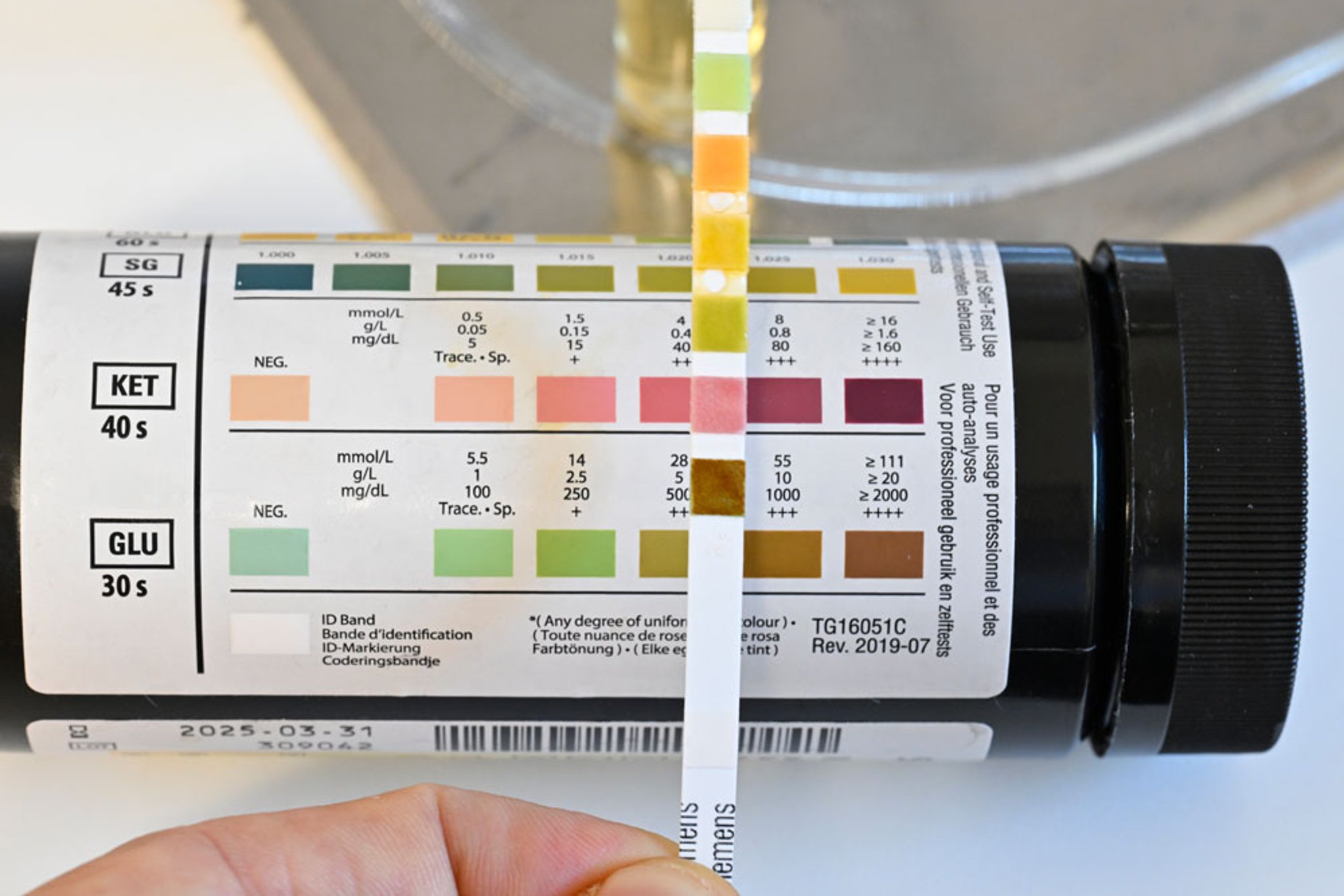 Complications of Diabetes in Children and Adolescents - Children's ...