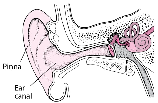 Quick Facts:Dermatitis of the Ear Canal - MSD Manual Consumer Version