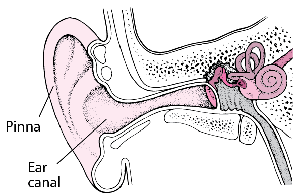 Quick Facts:Birth Defects of the Ear - MSD Manual Consumer Version