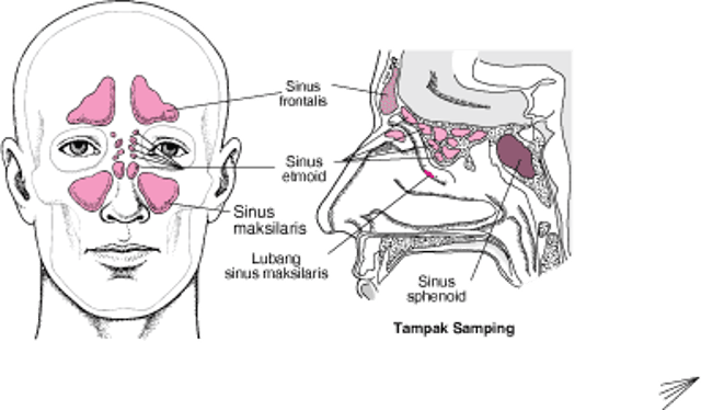 Sinusitis - Gangguan Telinga, Hidung, dan Tenggorokan - Manual MSD ...