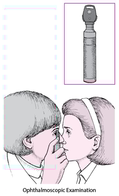 The Eye Examination - Eye Disorders - MSD Manual Consumer Version