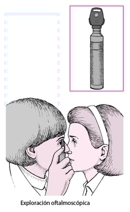 Exploración de los ojos - Trastornos oftálmicos - Manual MSD versión ...