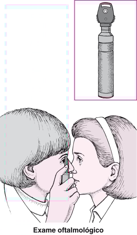 O exame do olho - Distúrbios oftalmológicos - Manual MSD Versão Saúde ...