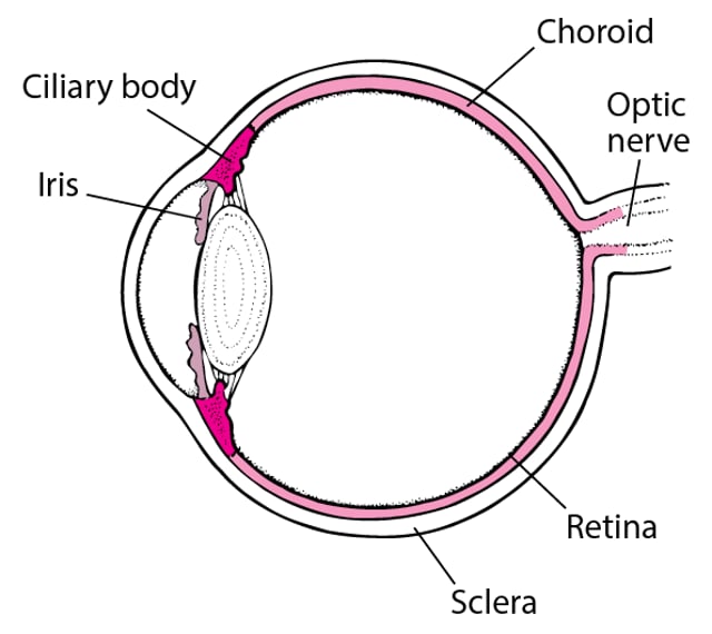 Uveitis - Eye Disorders - MSD Manual Consumer Version