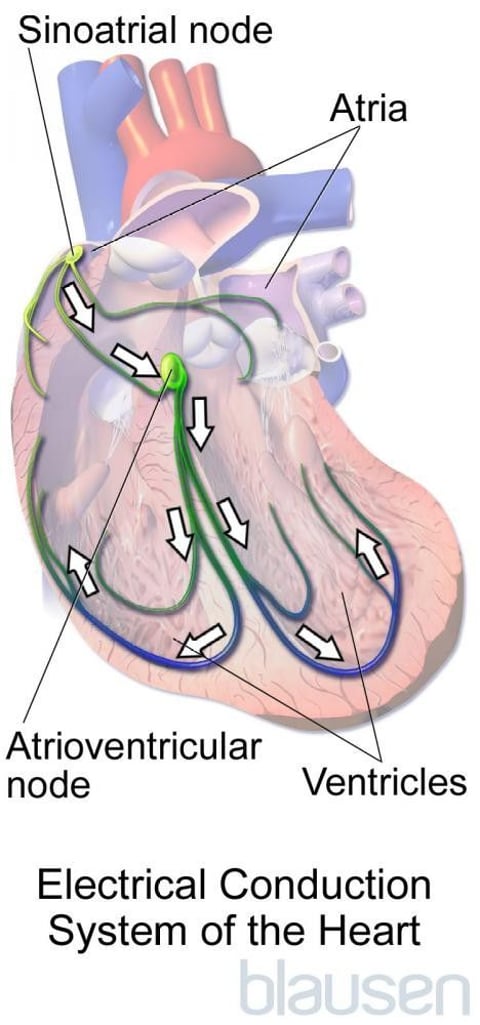 Fakta Singkat:Heart Block (Penyumbatan Jantung) - Manual MSD Versi Konsumen