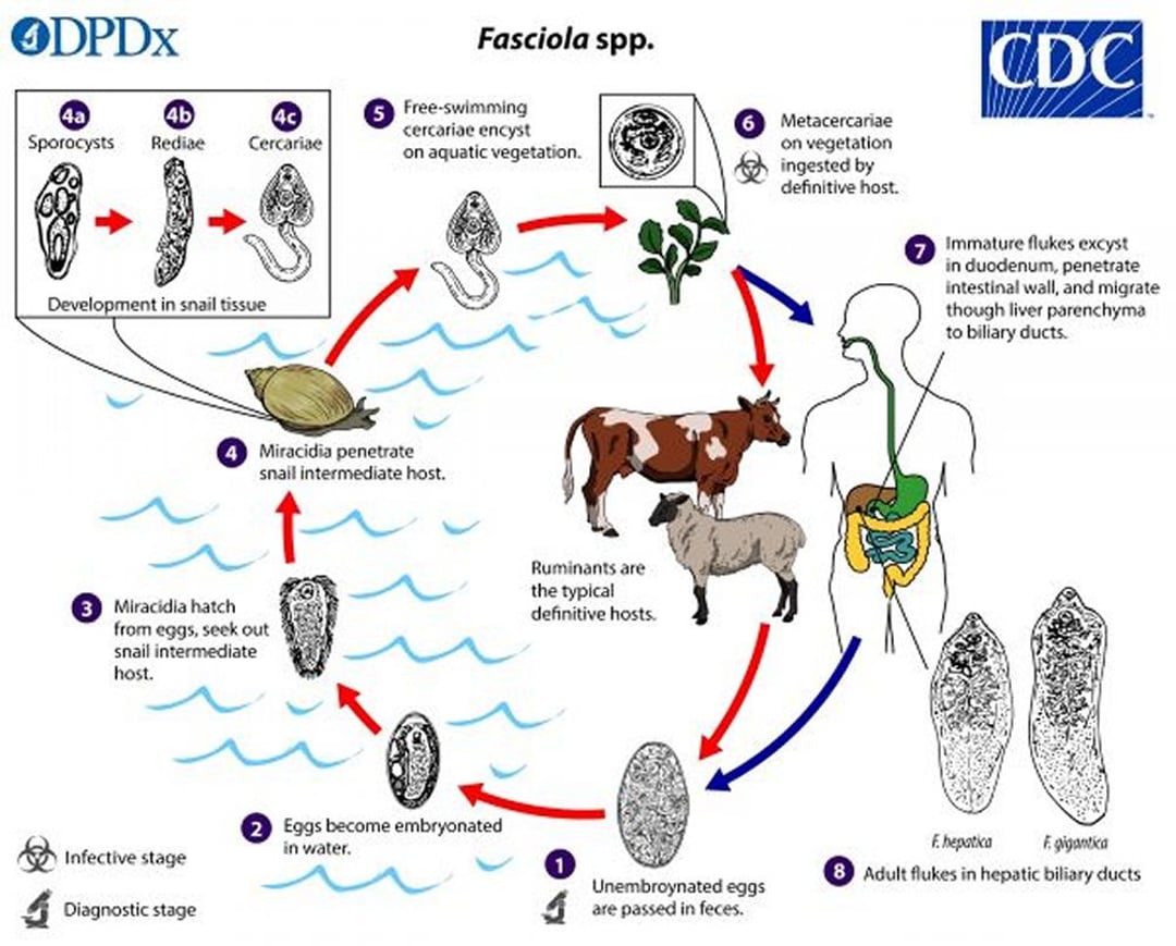 Fluke Infections of the Liver - Infections - MSD Manual Consumer Version