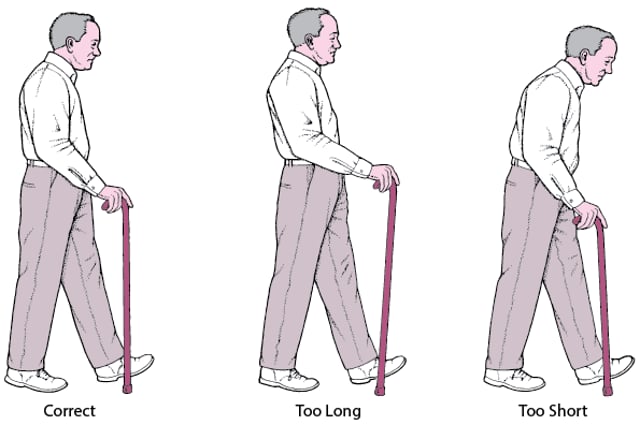 Rehabilitation After a Hip Fracture - Fundamentals - Merck Manual ...