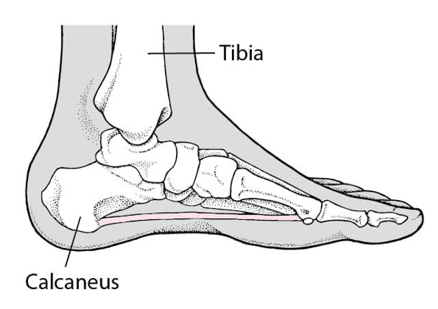 Fractures de l’os du talon - Fractures de l’os du talon - Manuels MSD ...
