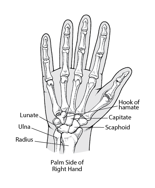 Dislocations of Bones of the Hand - Injuries and Poisoning - Merck ...