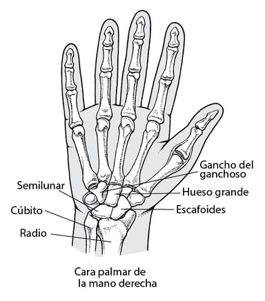 Luxaciones de los huesos de la mano - Traumatismos y envenenamientos ...