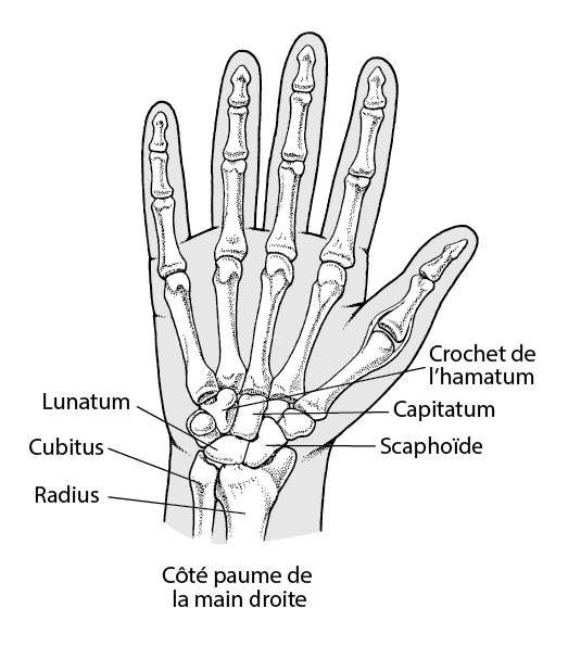 Luxations des os de la main - Lésions et intoxications - Manuels MSD ...