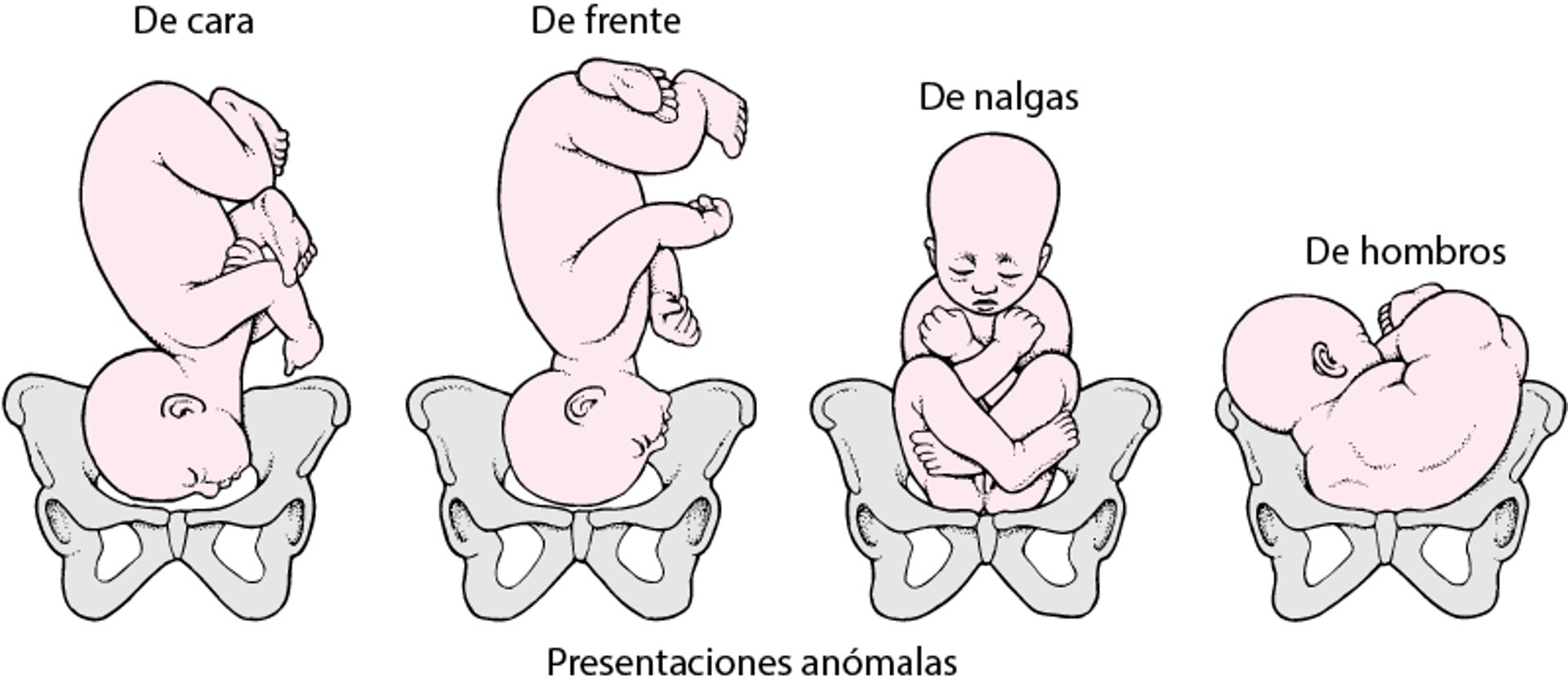 Image:Posición y presentación del feto-Manual MSD versión para ... Image:Posición y presentación del feto-Manual MSD versión para ...