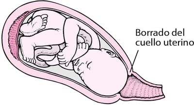 Table: Etapas del parto-Manual MSD versión para público general