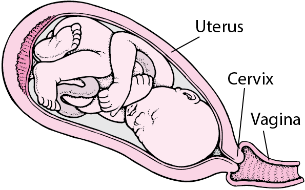 Cervical Insufficiency - Women's Health Issues - MSD Manual Consumer ...