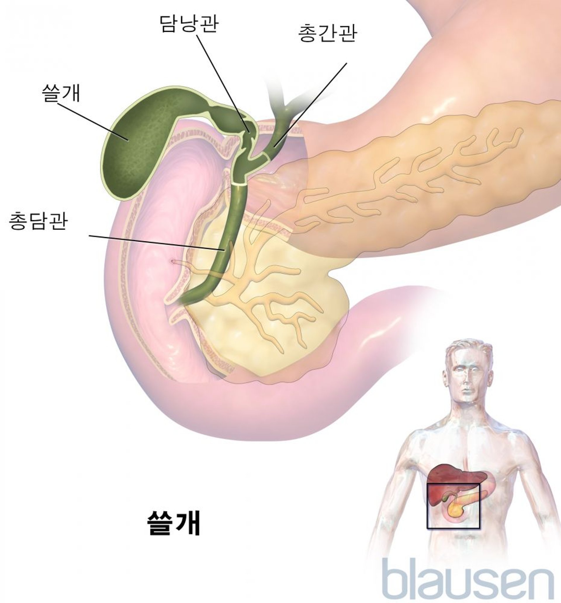 담낭 및 담관 간 및 담낭 장애 Msd 매뉴얼 일반인용
