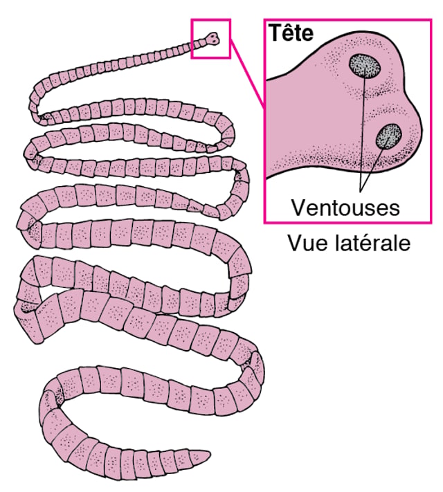 Infestation par des cestodes - Infections - Manuels MSD pour le grand ...