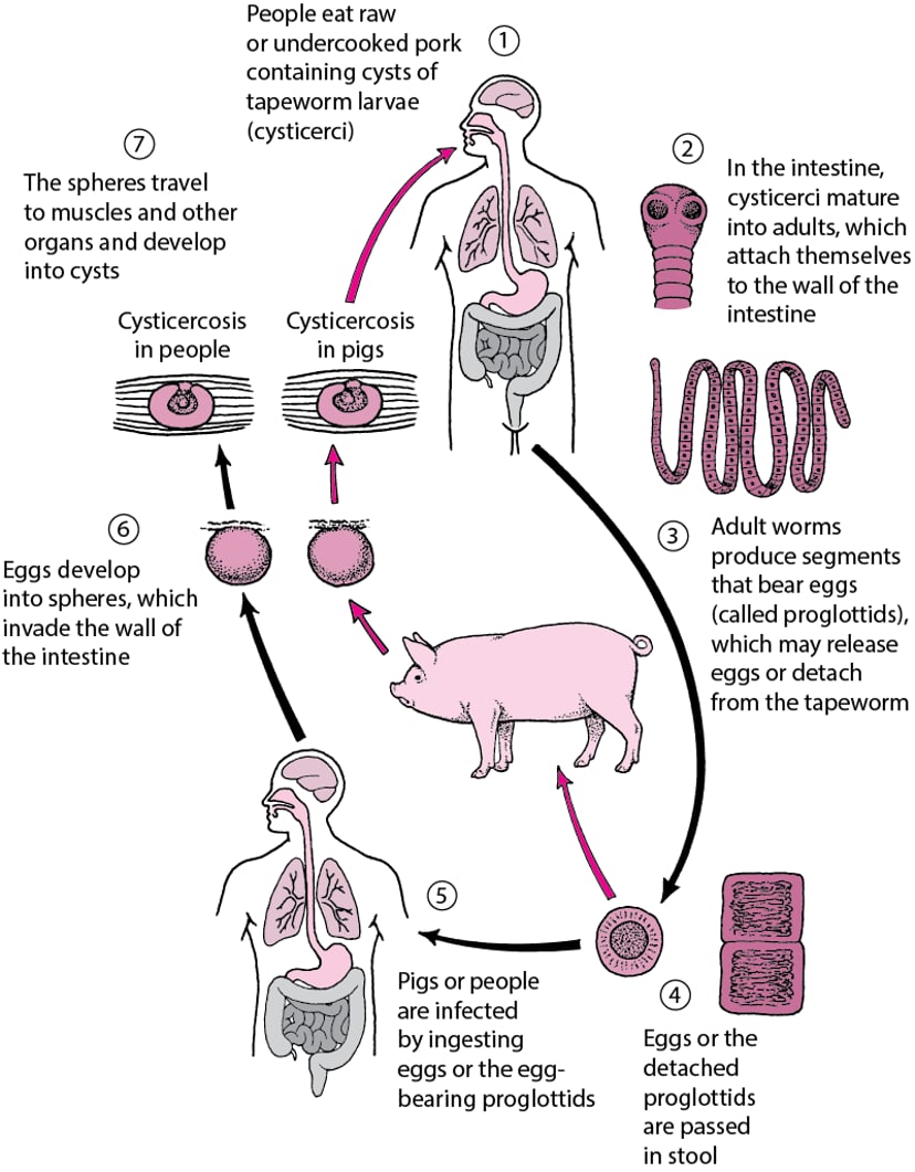 Image:Life Cycle of the Pork Tapeworm-MSD Manual Consumer Version