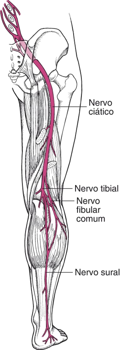 Ciática - Distúrbios ósseos, articulares e musculares - Manual MSD ...