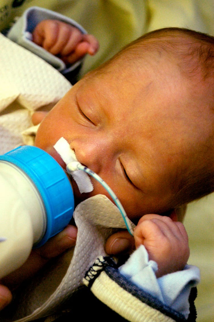 Jaundice in the Newborn - Children's Health Issues - Merck Manual ...