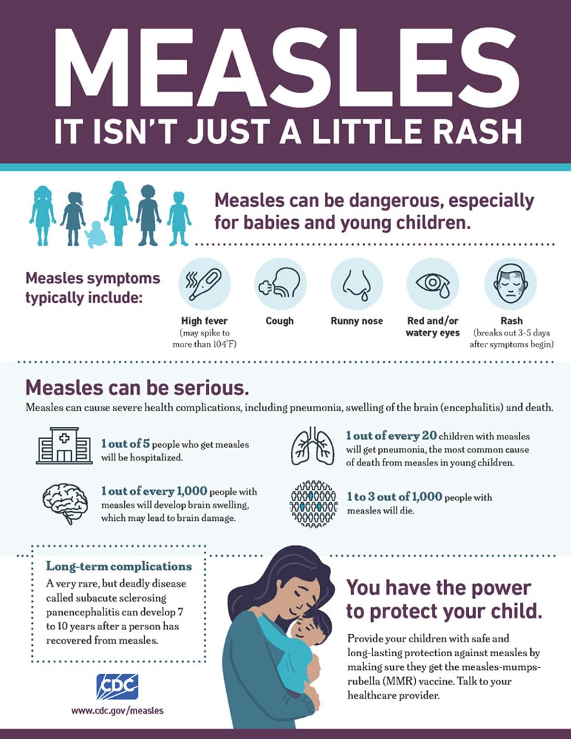 Measles - Children's Health Issues - MSD Manual Consumer Version