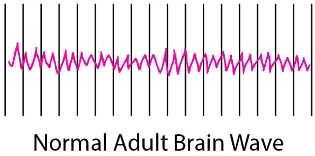 Image:Recording Brain Activity-MSD Manual Consumer Version