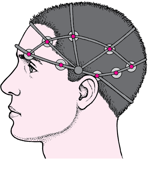 やさしくわかる病気事典:脳波検査のうはけんさ（EEG） - MSDマニュアル家庭版